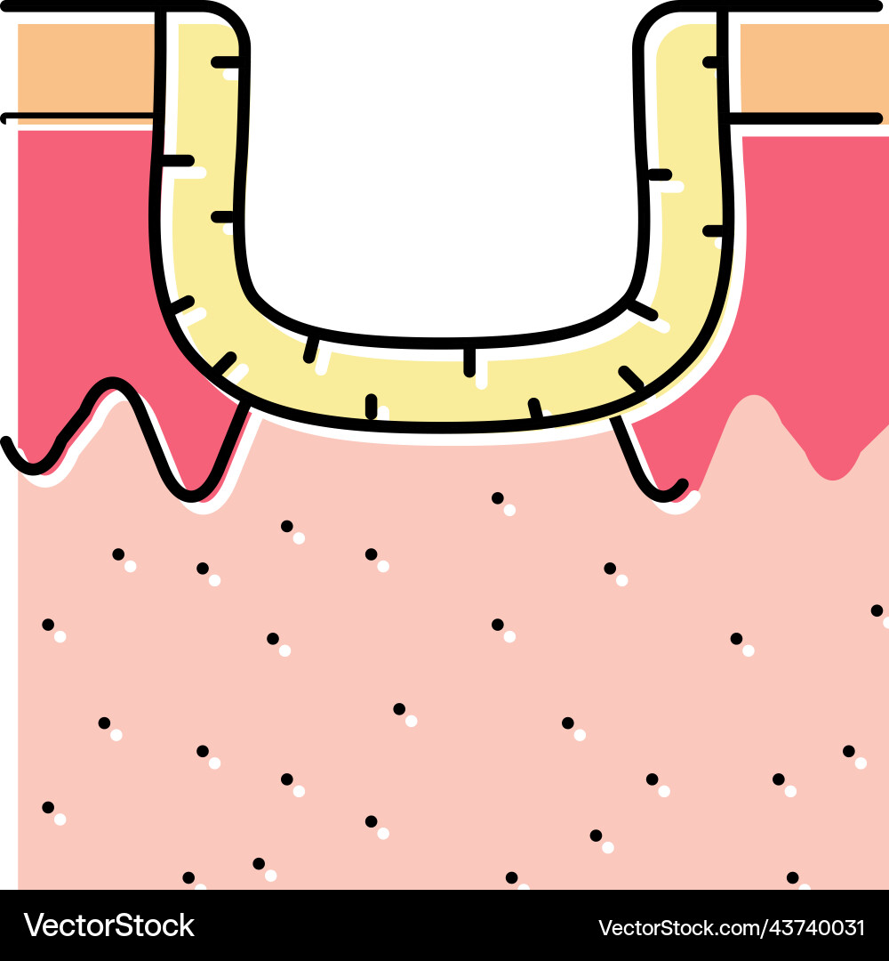 Hypertrophic acne scar color icon Royalty Free Vector Image