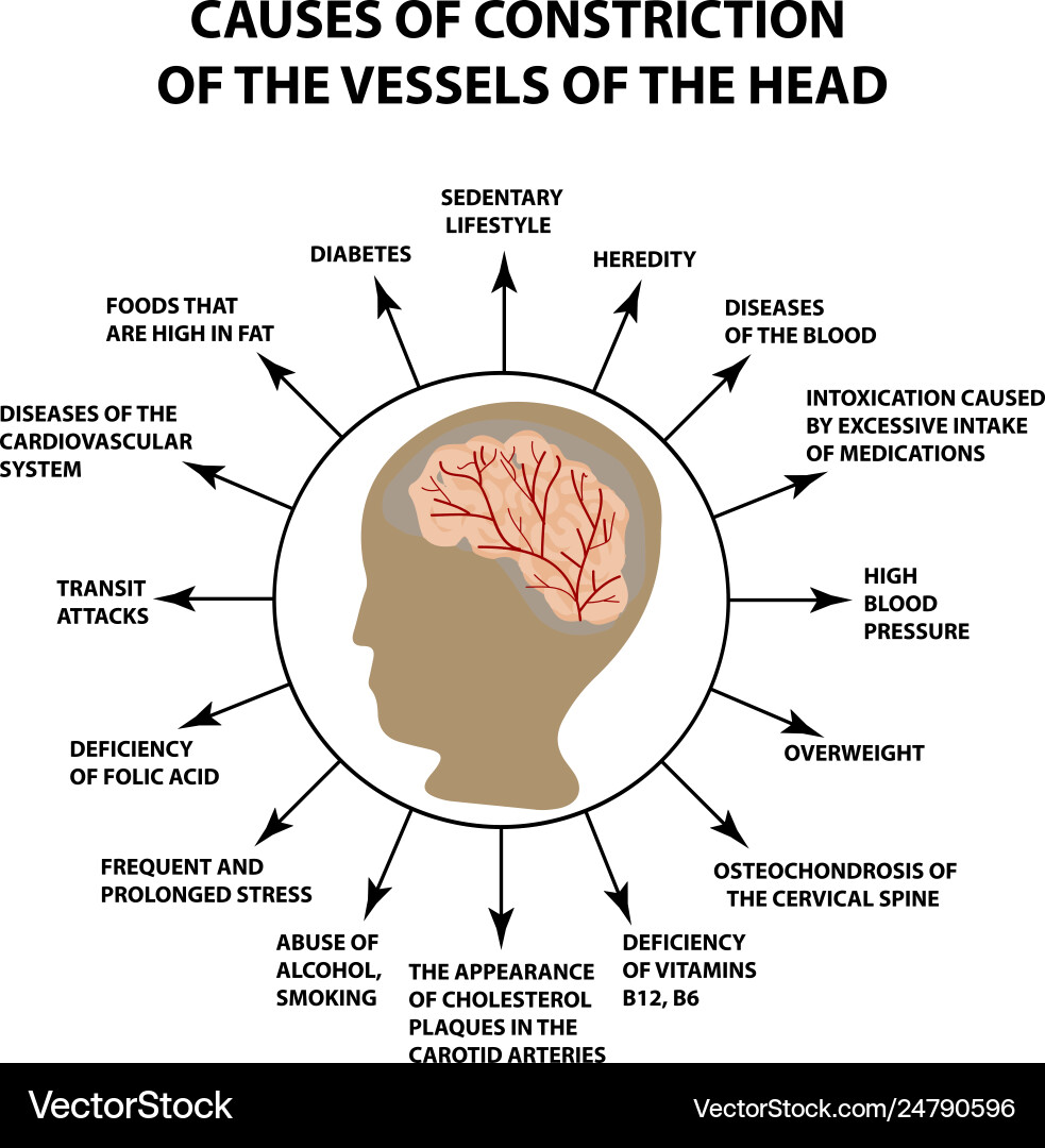 Causes narrowing cerebral vessels world Royalty Free Vector
