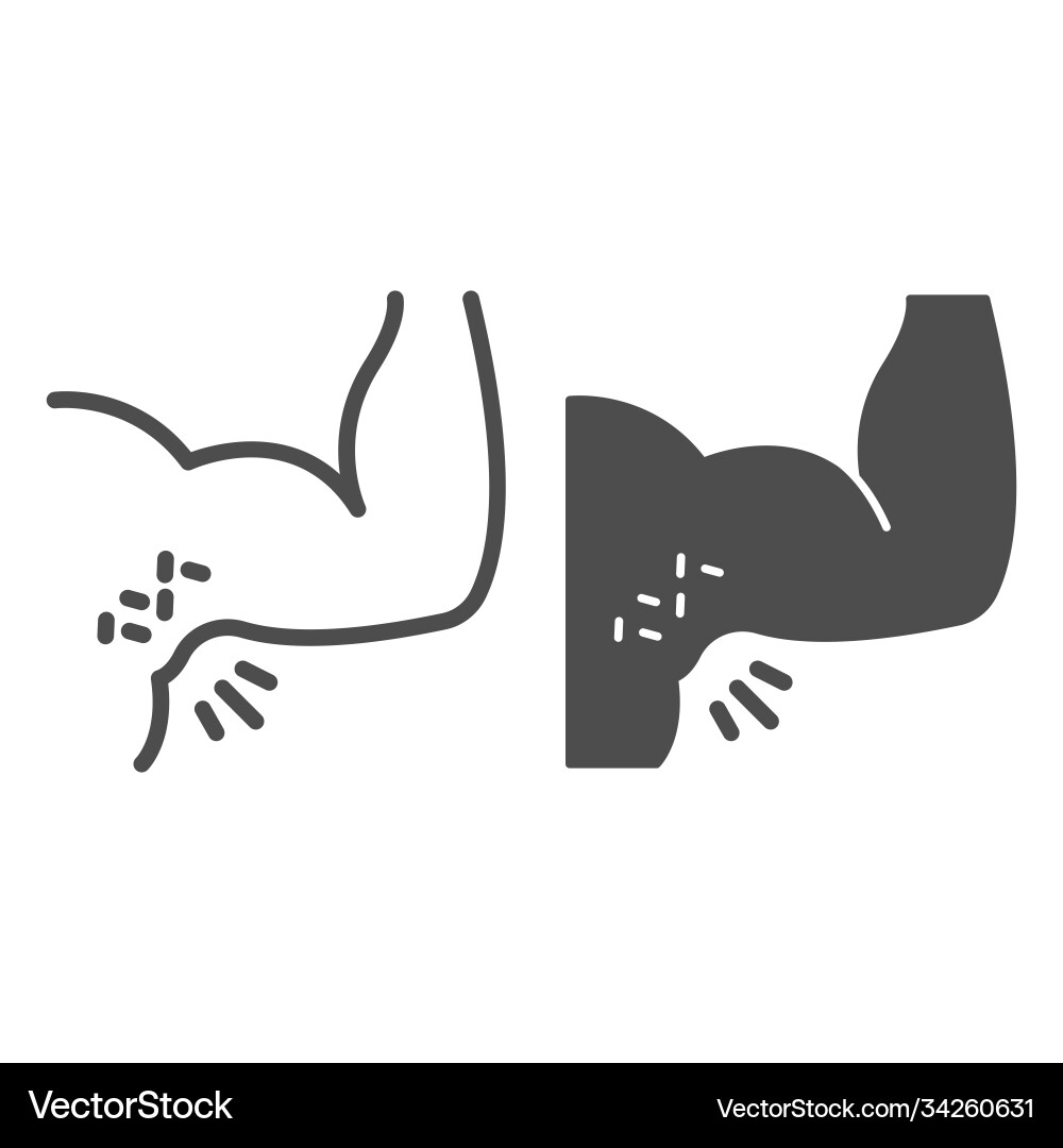 Rash in armpit line and solid icon allergy Vector Image