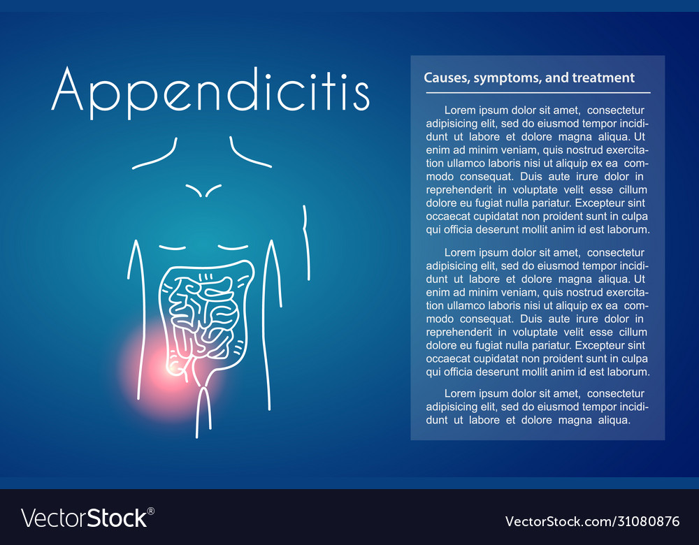 Appendicitis blue background Royalty Free Vector Image