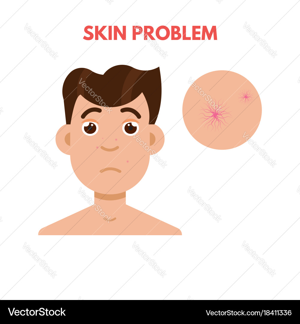 Men skin problem facial care Royalty Free Vector Image