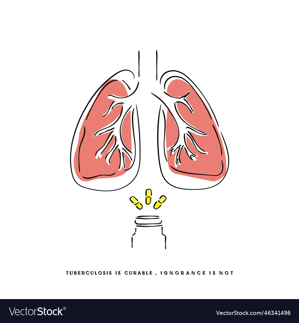 Tuberculosis intervention Royalty Free Vector Image