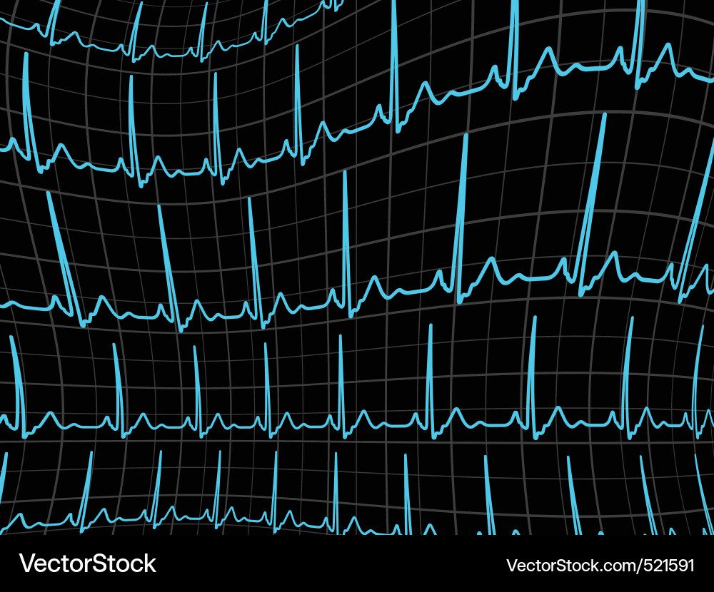 Ecg monitor Royalty Free Vector Image - VectorStock