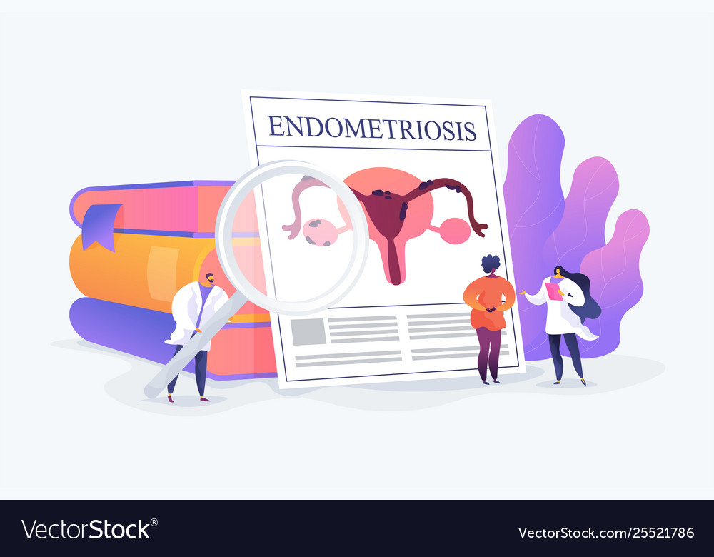Endometriosis concept Royalty Free Vector Image