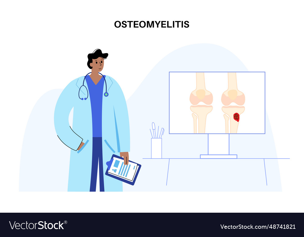 Tibia bone osteomyelitis Royalty Free Vector Image