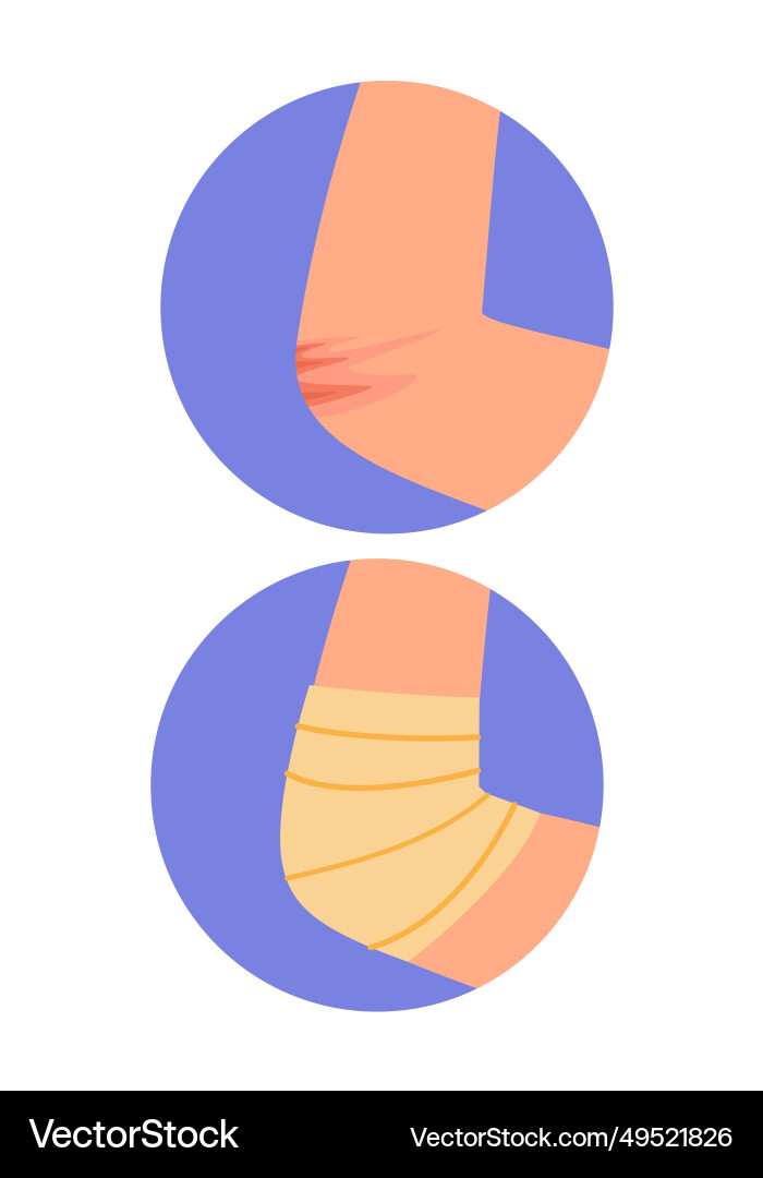 Types of bandages set Royalty Free Vector Image