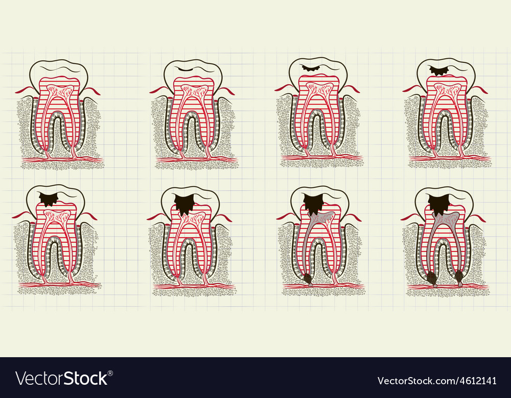 Bad tooth Royalty Free Vector Image - VectorStock