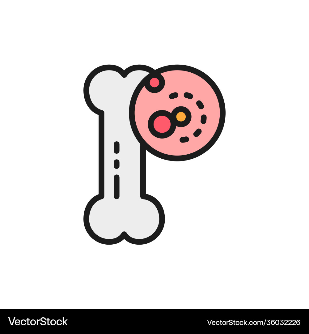 Bone cancer sarcoma malignant tumor oncology Vector Image