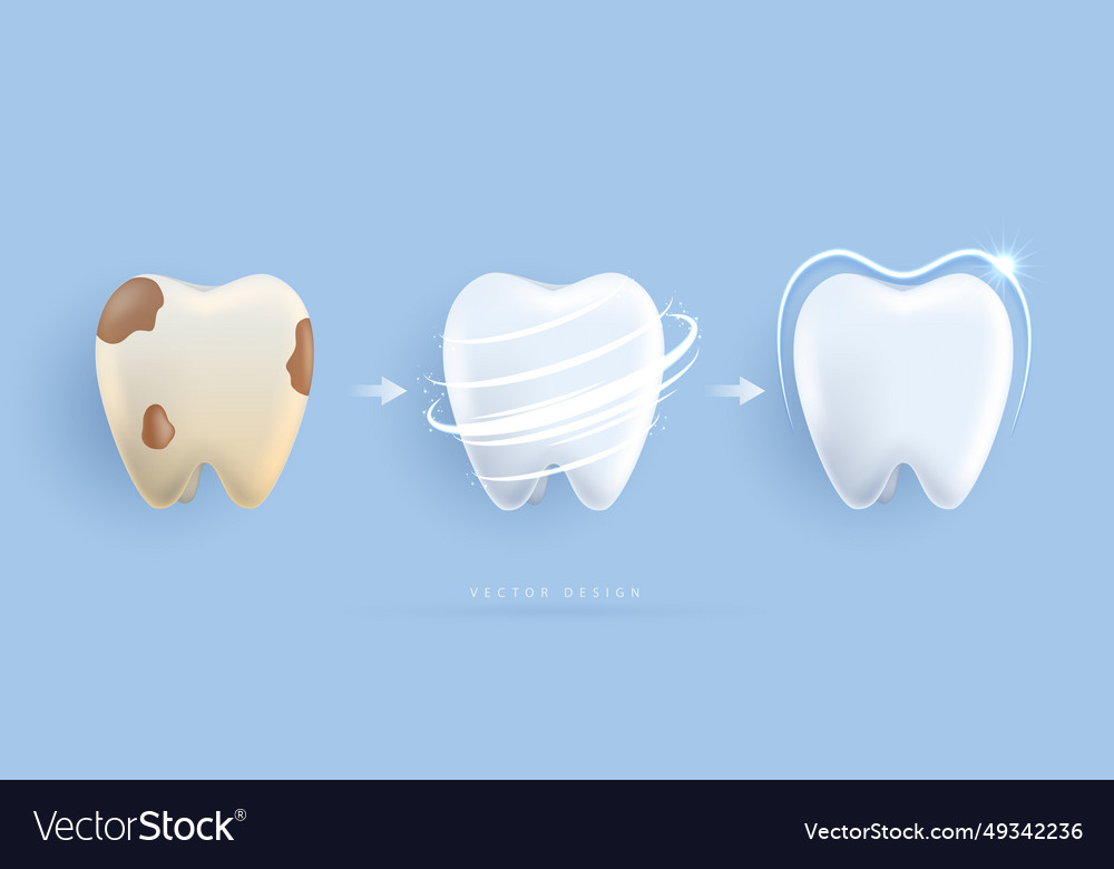 Set of dental cleaning and whitening teeth Vector Image