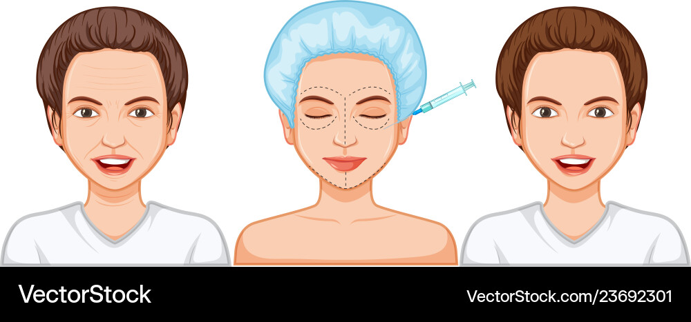 Comparison of female botox injection Royalty Free Vector