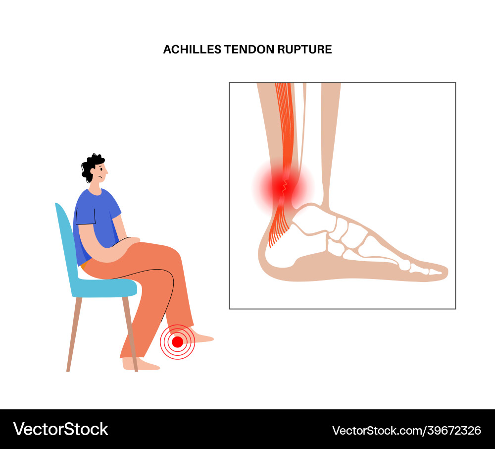 Achilles tendon injury Royalty Free Vector Image