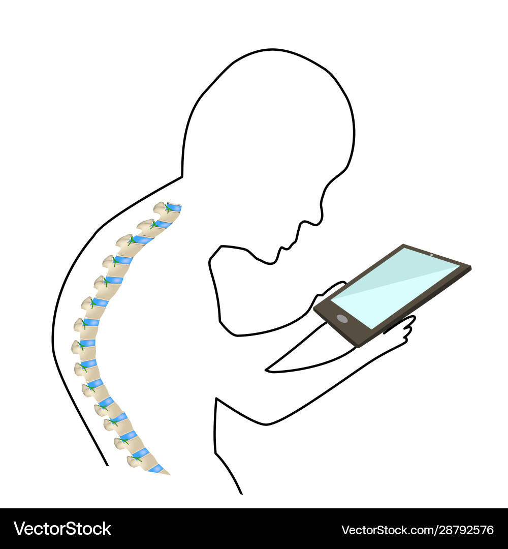 Text neck syndrome spinal curvature kyphosis Vector Image
