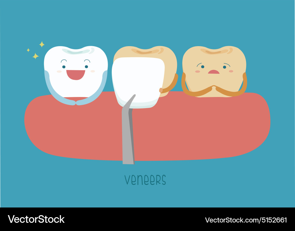 Veneers teeth of dental Royalty Free Vector Image