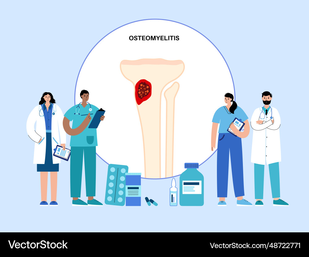 Tibia bone osteomyelitis Royalty Free Vector Image