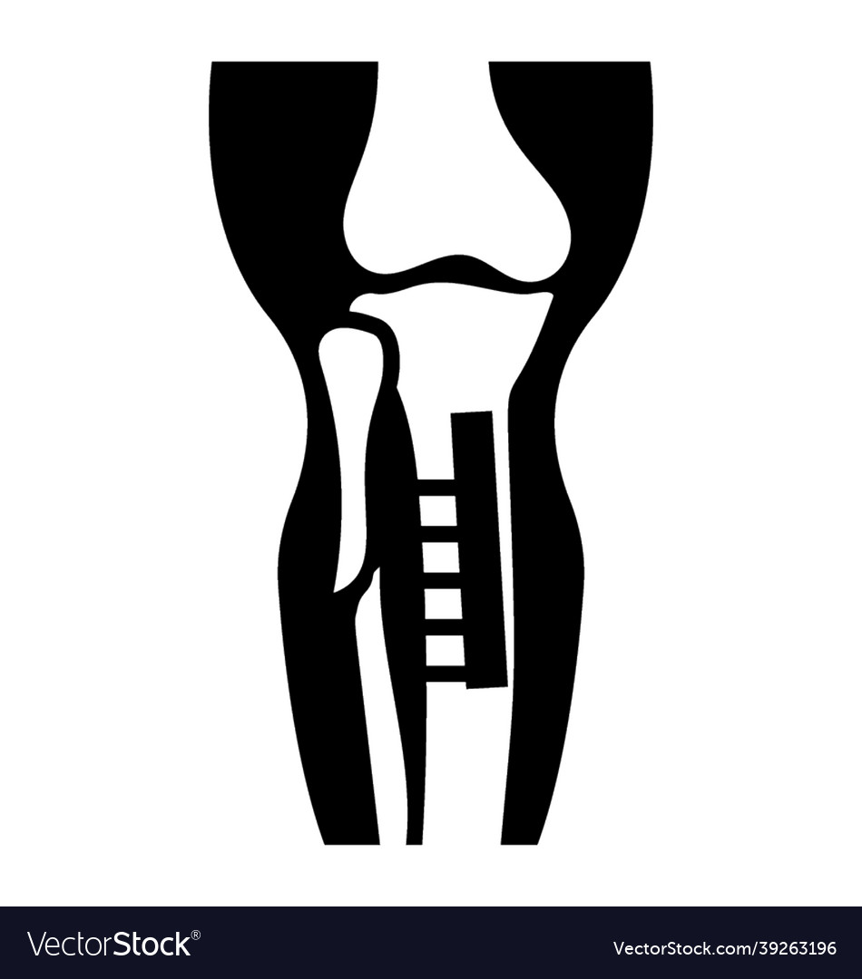 Joint Royalty Free Vector Image - VectorStock