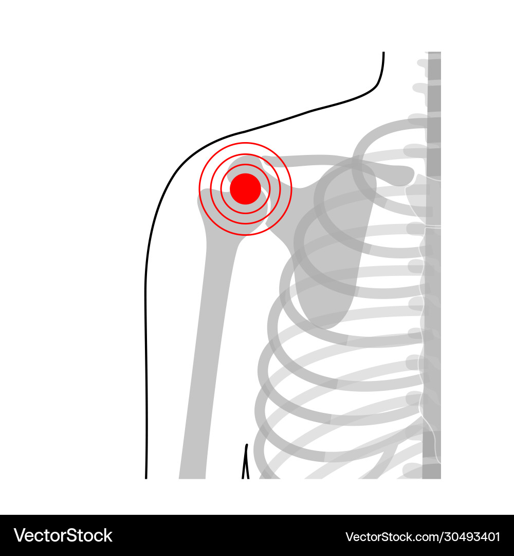 Human shoulder joint pain anatomy Royalty Free Vector Image