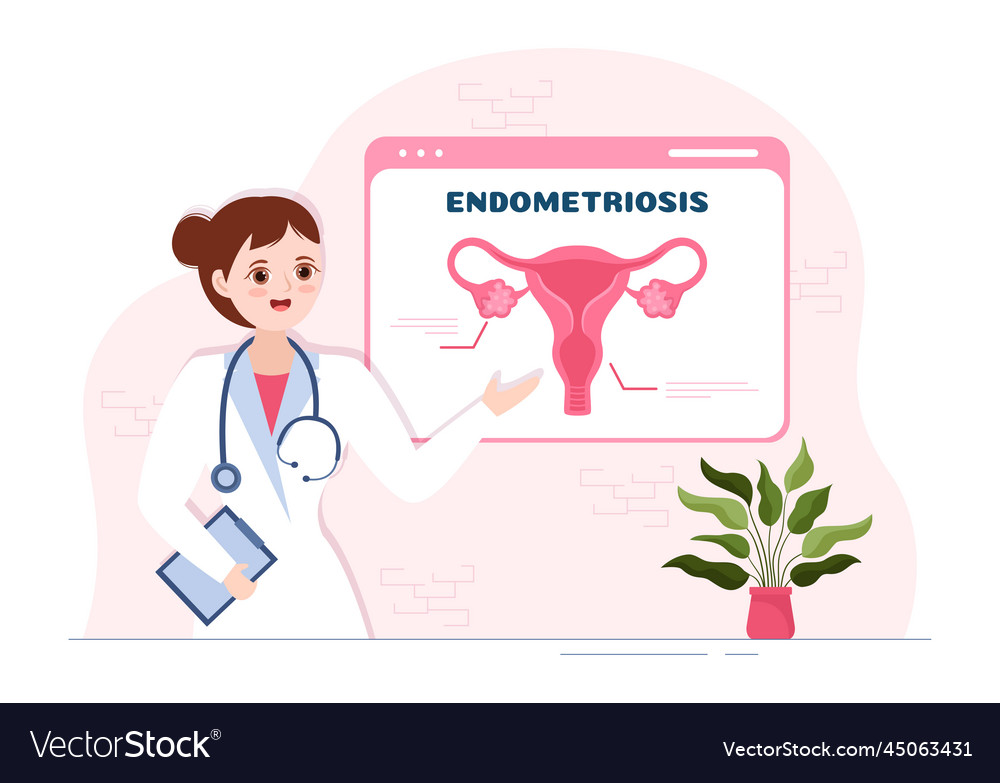 Endometriosis with condition the endometrium Vector Image
