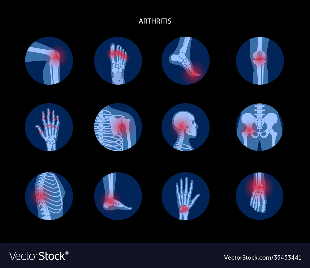 Human bones concept Royalty Free Vector Image - VectorStock