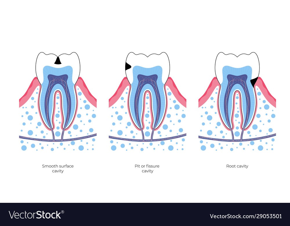 Isolated tooth Royalty Free Vector Image - VectorStock