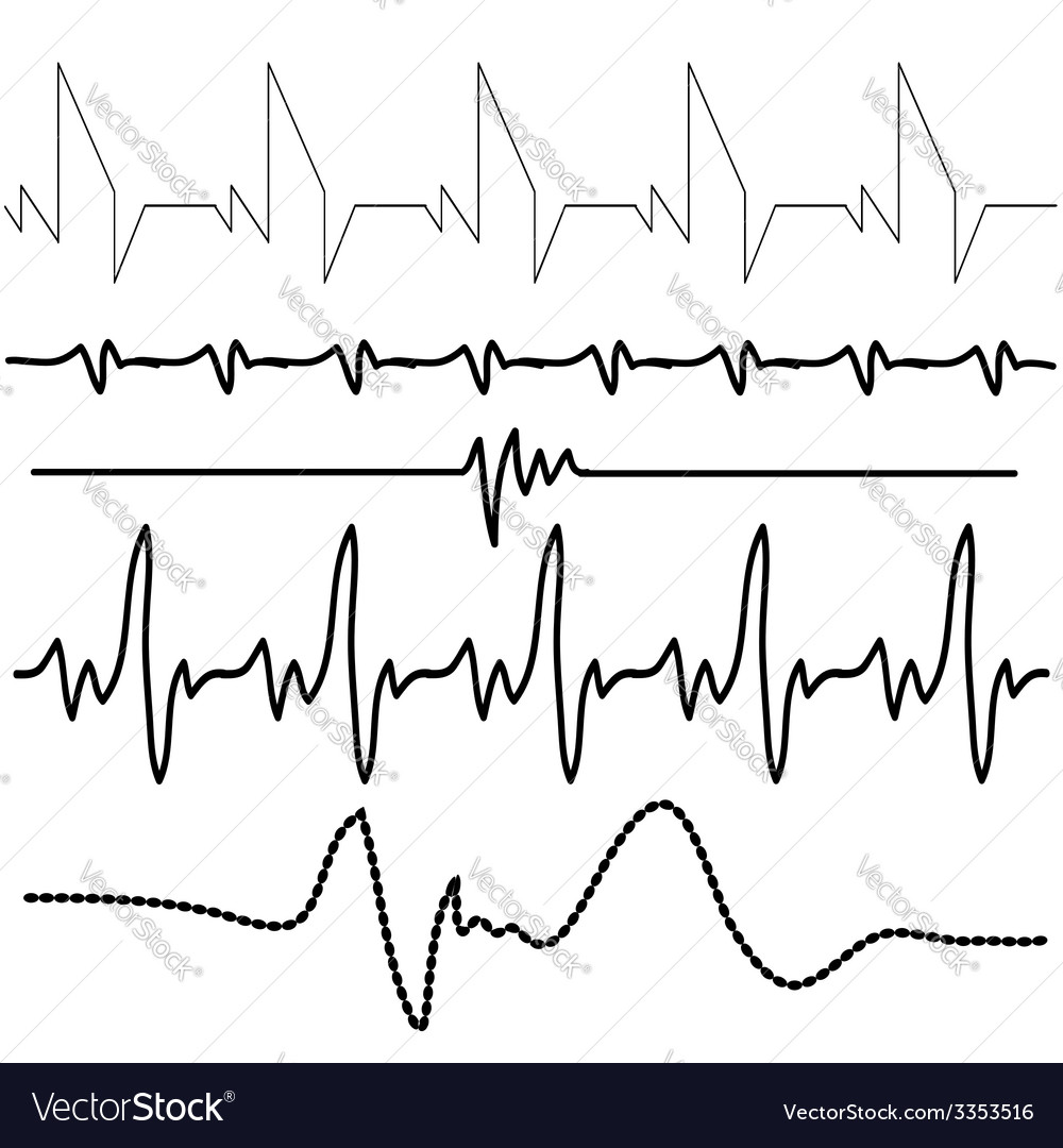 Cardiogram Royalty Free Vector Image - VectorStock