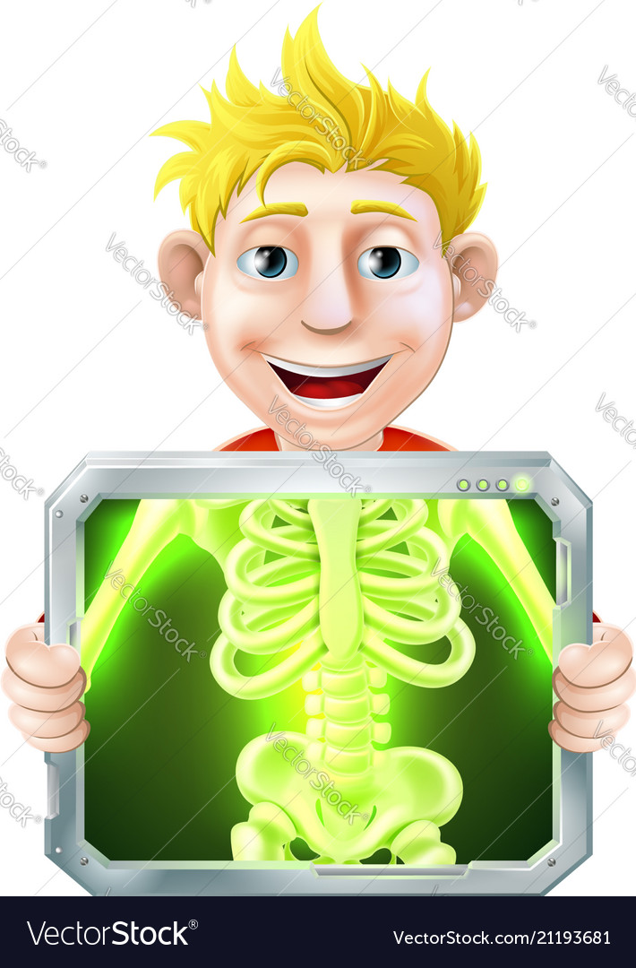 X-ray Royalty Free Vector Image - VectorStock
