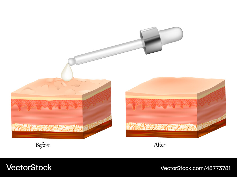 With healthy and damaged skin Royalty Free Vector Image