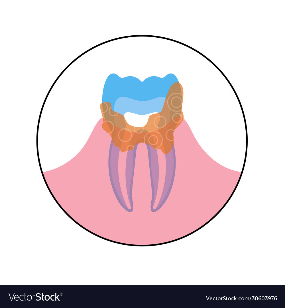Isolated tooth Royalty Free Vector Image - VectorStock