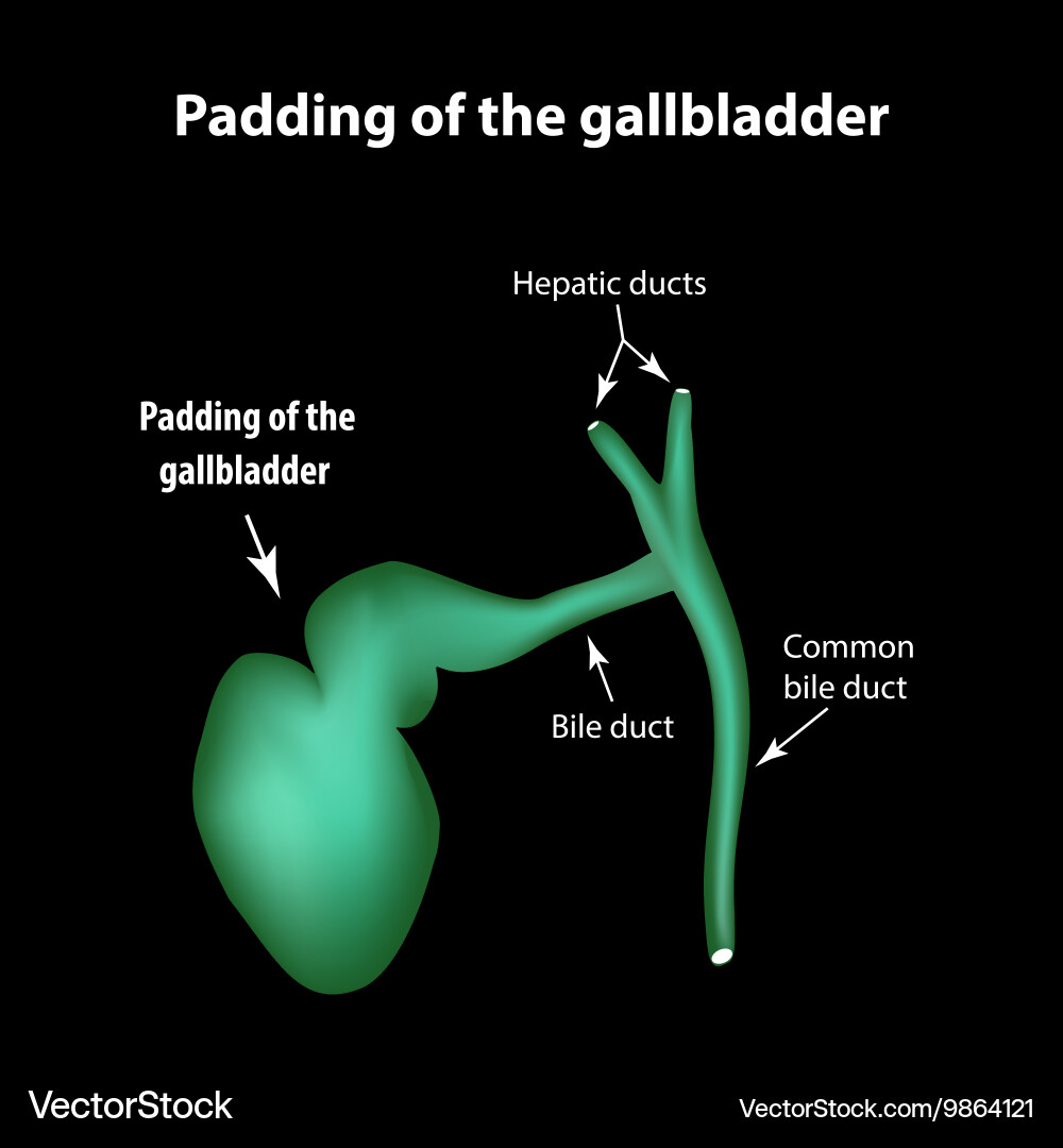 Padding of the gallbladder Pathology of the Vector Image