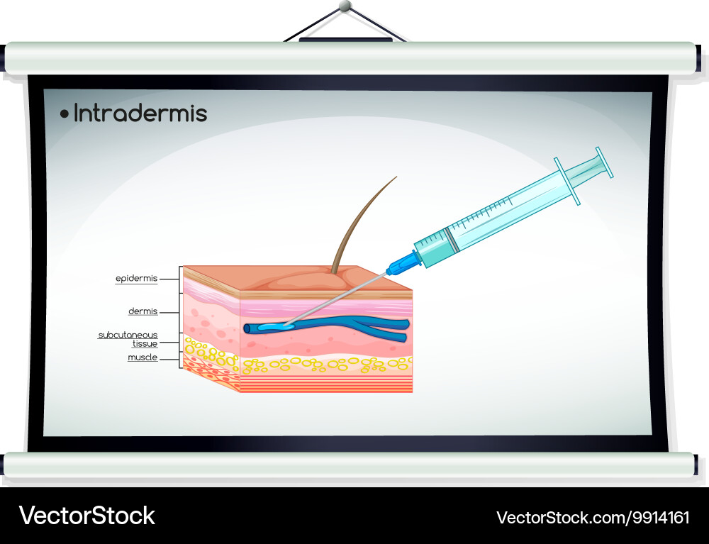Diagram showing intradermis injection Royalty Free Vector