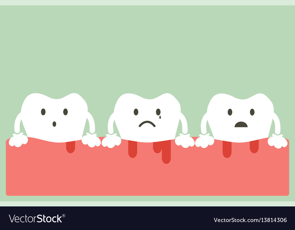 Gingivitis and bleeding Royalty Free Vector Image