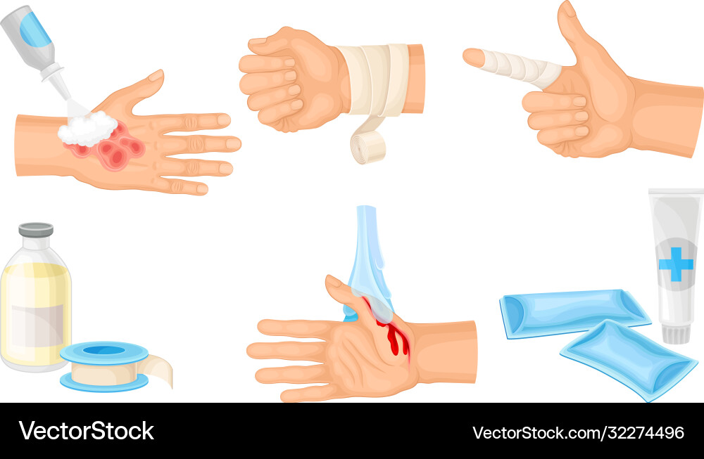 Hands with injured skin and procedures Royalty Free Vector