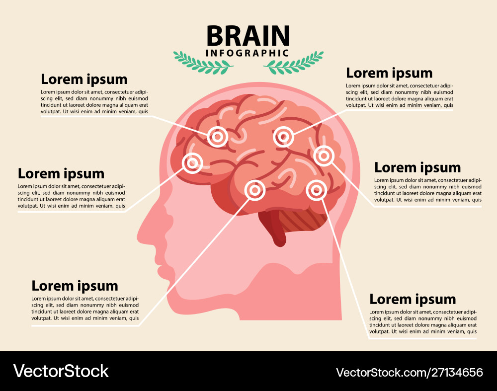 Human Brain Stroke Medical Diagram Royalty Free Vector Image