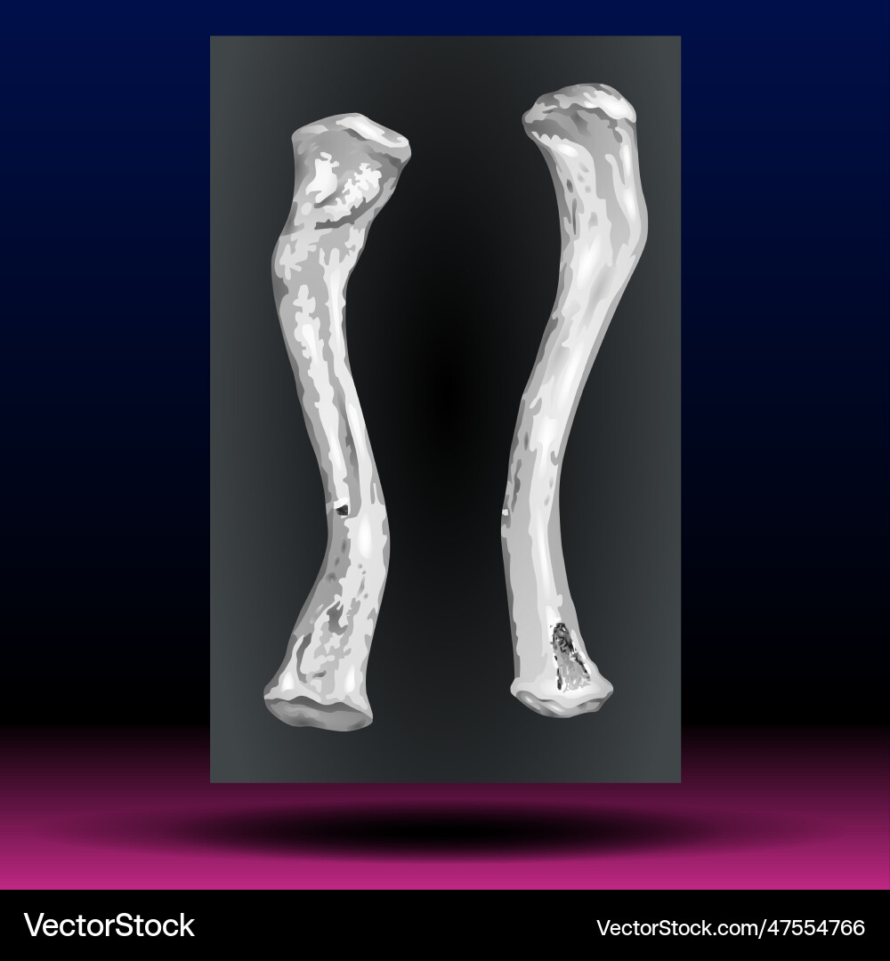 157 x-ray of shoulder bone 01 Royalty Free Vector Image