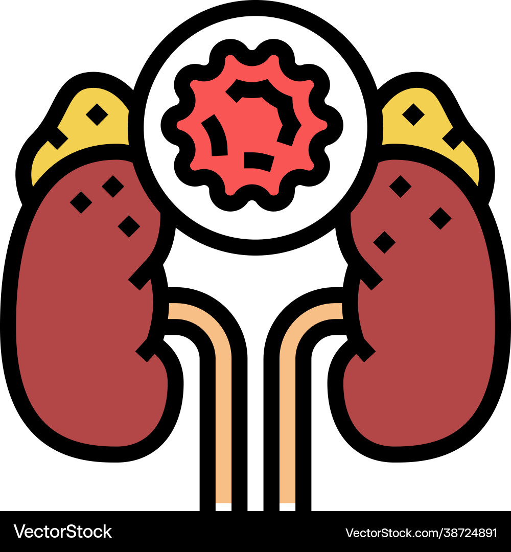 Cushing cortisol syndrome color icon Royalty Free Vector