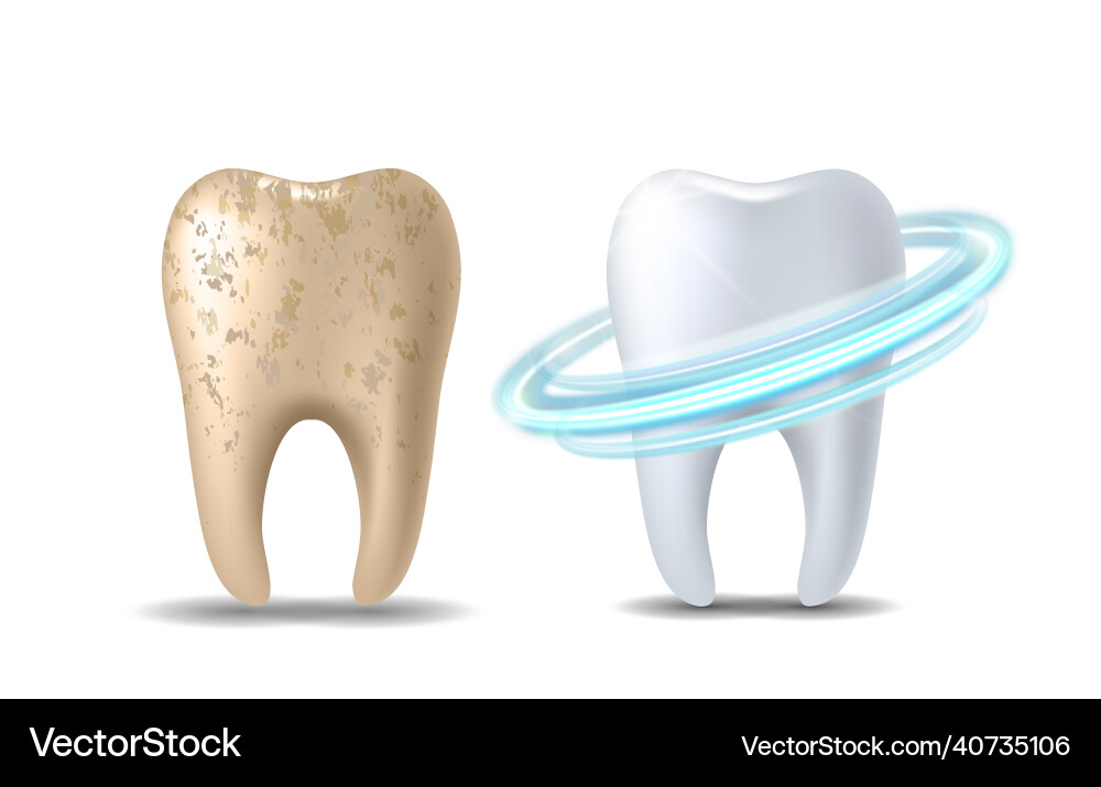 Clean and dirty tooth before after whitening Vector Image