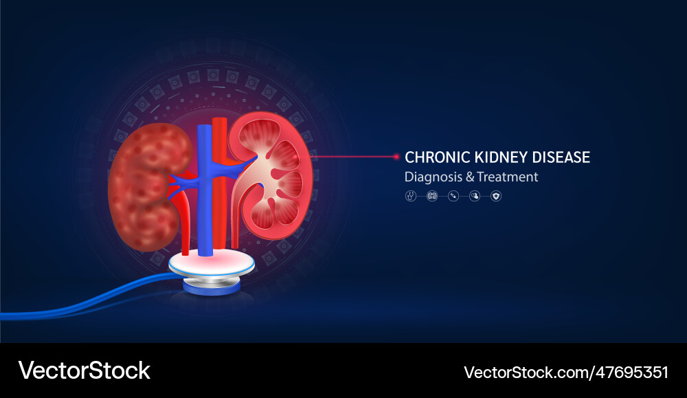Chronic kidney disease human kidneys red model Vector Image