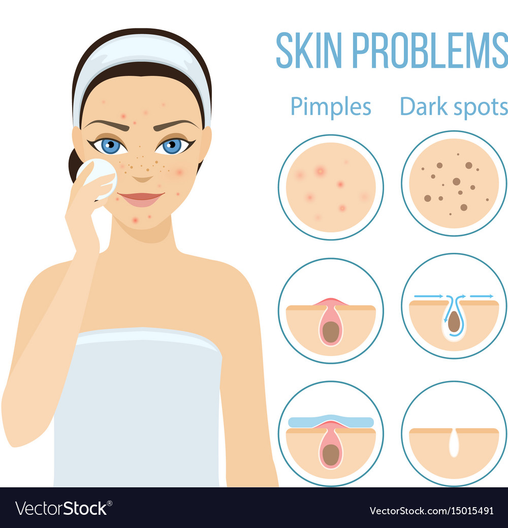 Skin problems solution lotion Royalty Free Vector Image