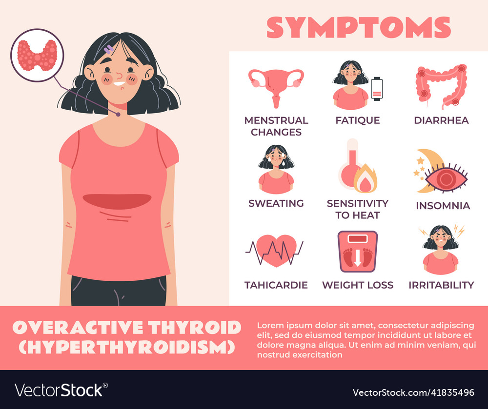 Hyperthyroidism infographic Royalty Free Vector Image