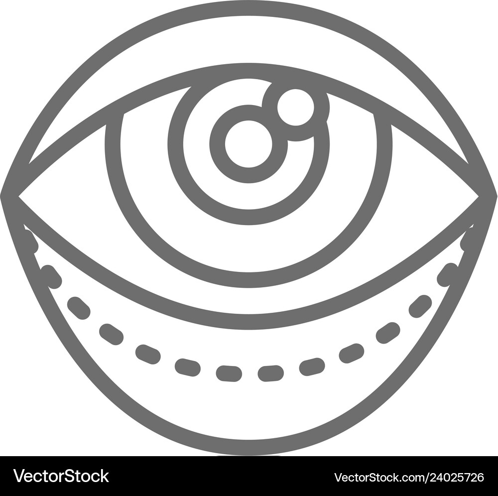 Blepharoplasty eyelid plastic surgery surgical Vector Image