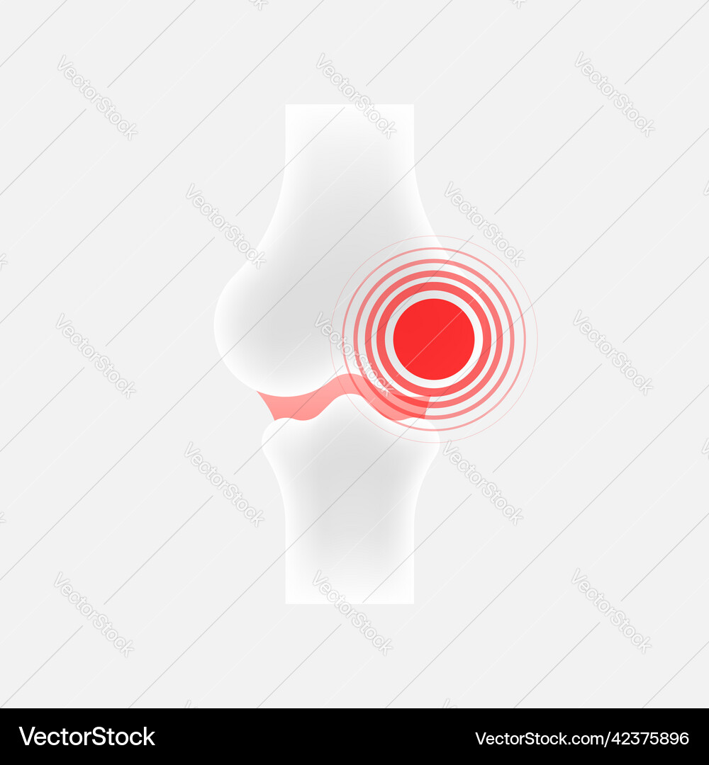 Infographic with joint pain human knee bone joint Vector Image