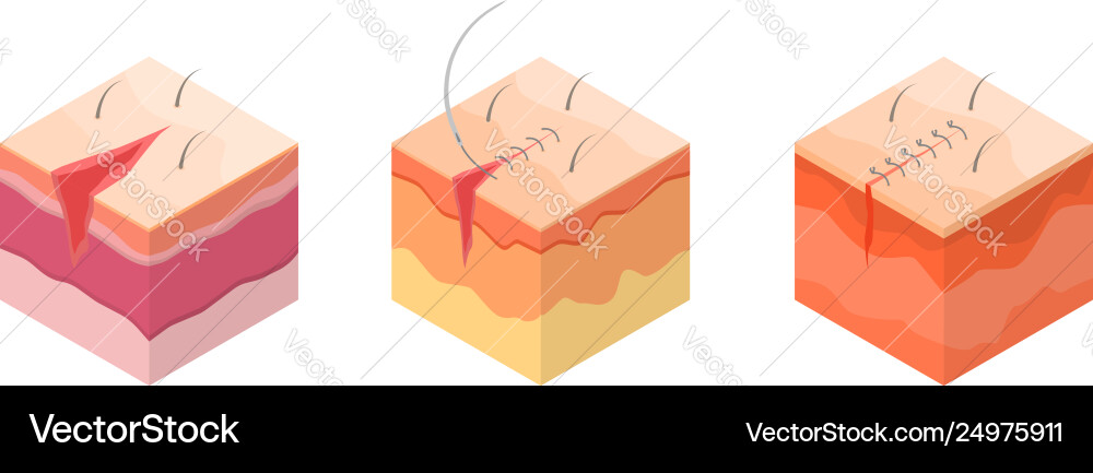 Surgical suture icons set isometric style Vector Image