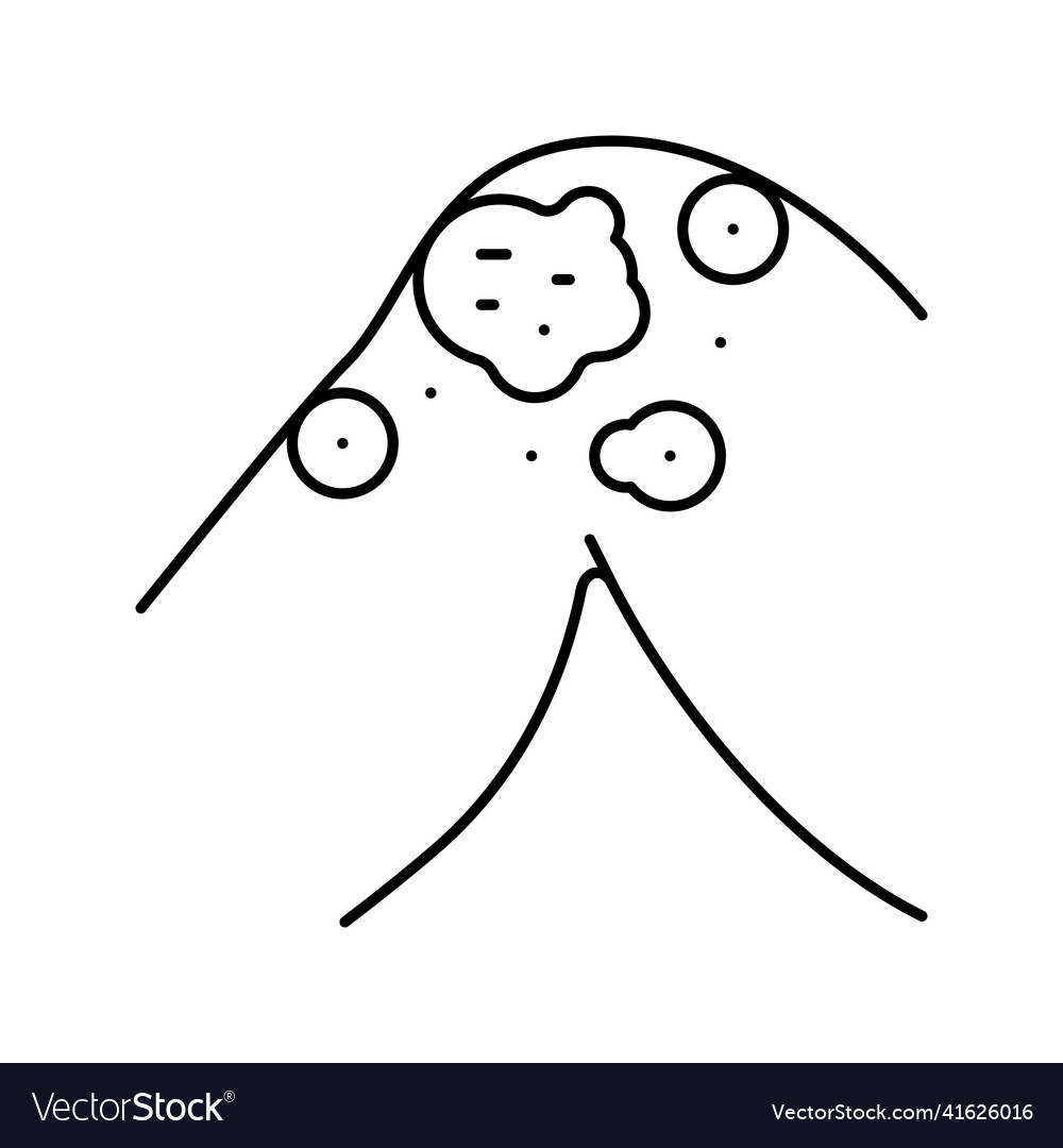 Atopic Dermatitis Line Icon Royalty Free Vector Image