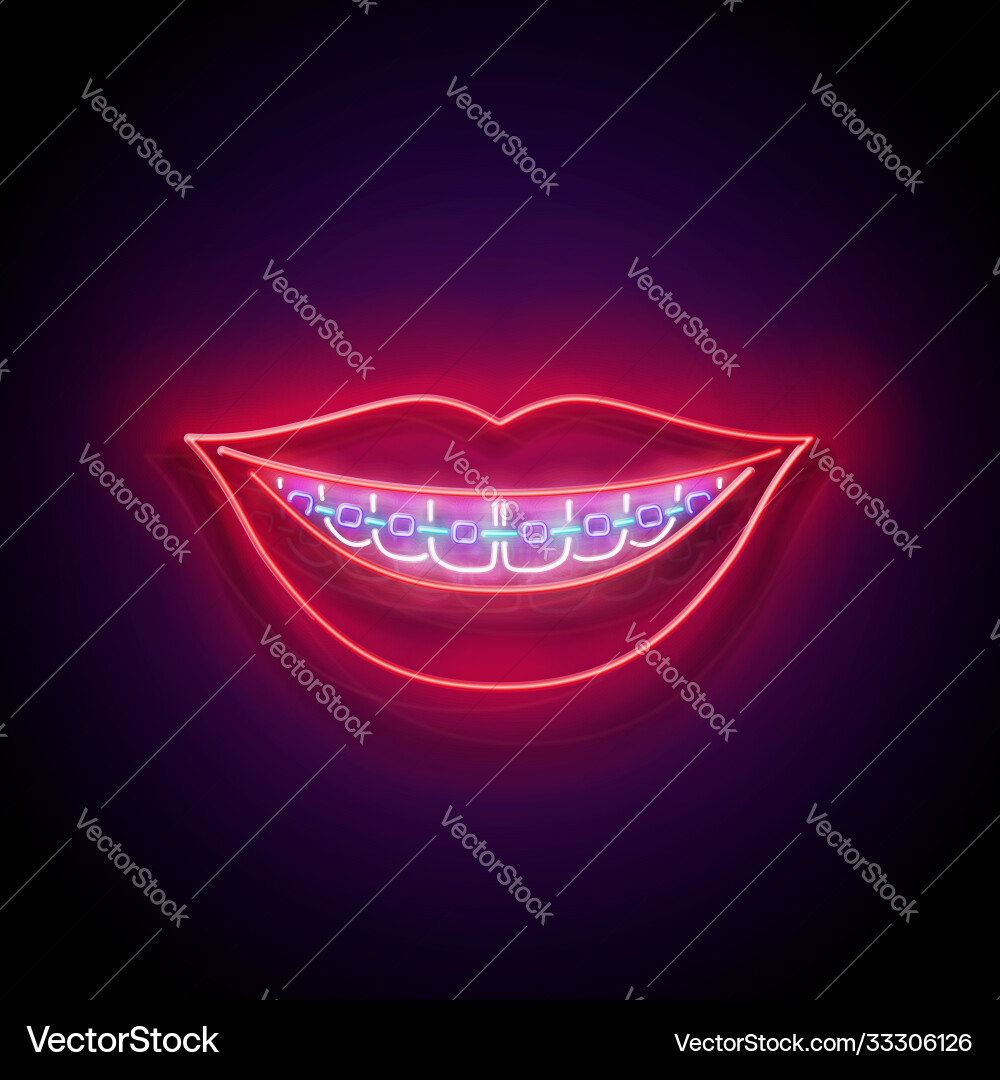 Braces Lips | Lipstutorial.org