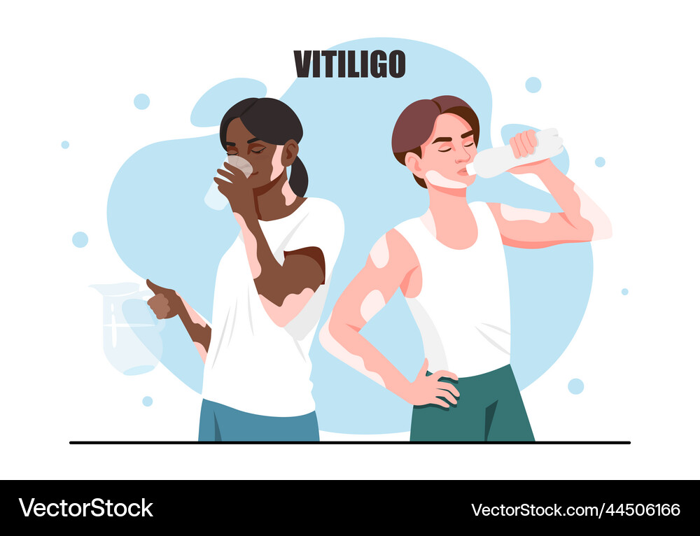 Concept of vitiligo Royalty Free Vector Image - VectorStock