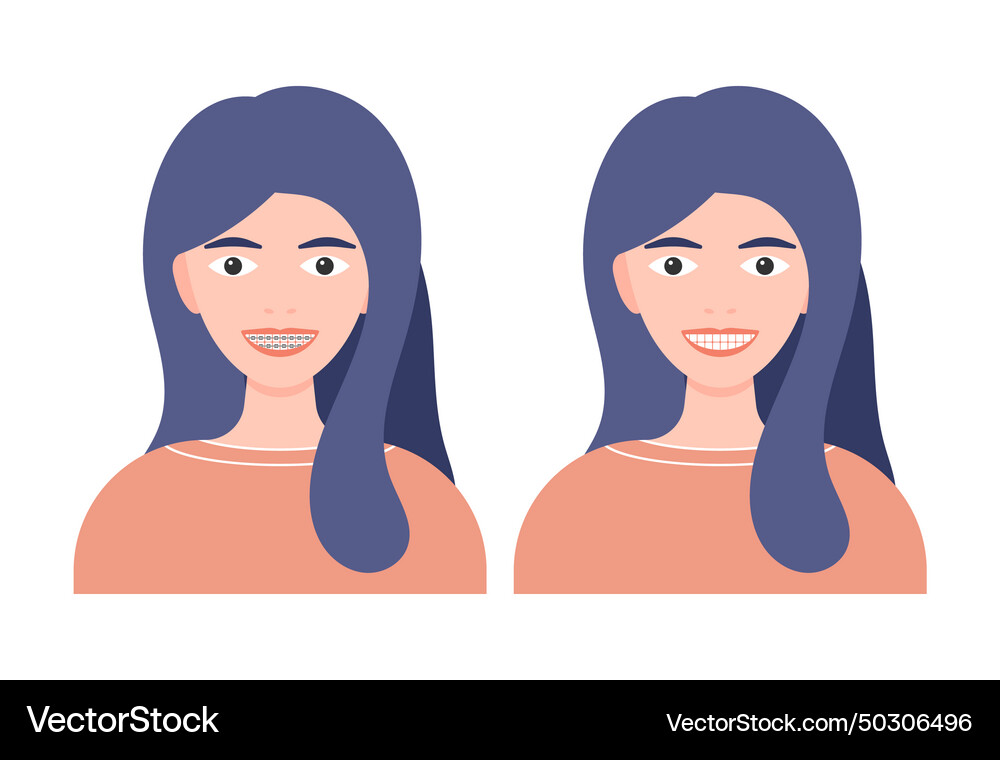 Woman with braces on her teeth Royalty Free Vector Image