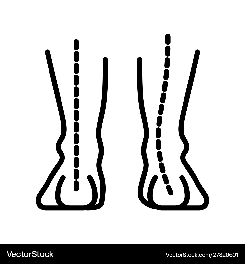 Ankle arch human foot pathology isolated line Vector Image