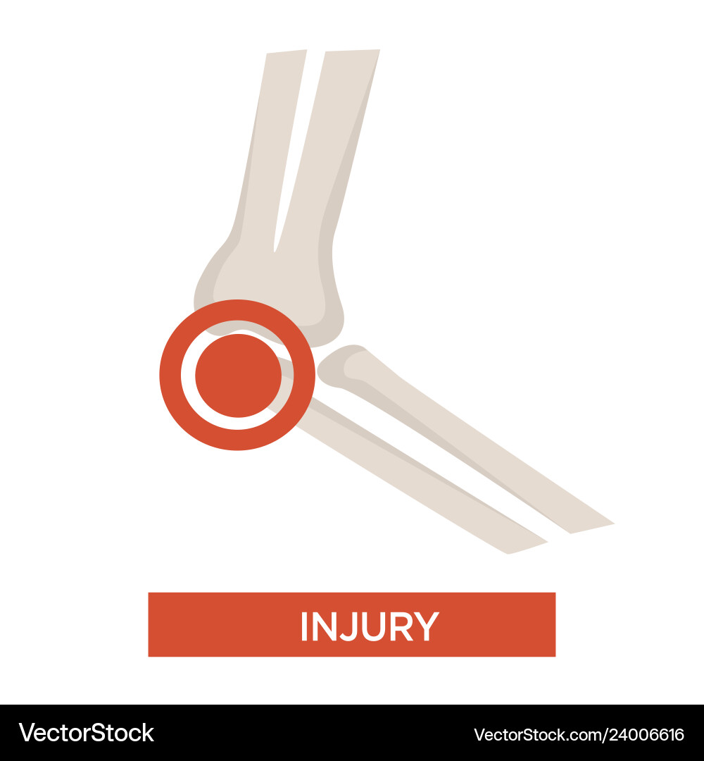 Bone injury joint damage isolated skeleton part Vector Image
