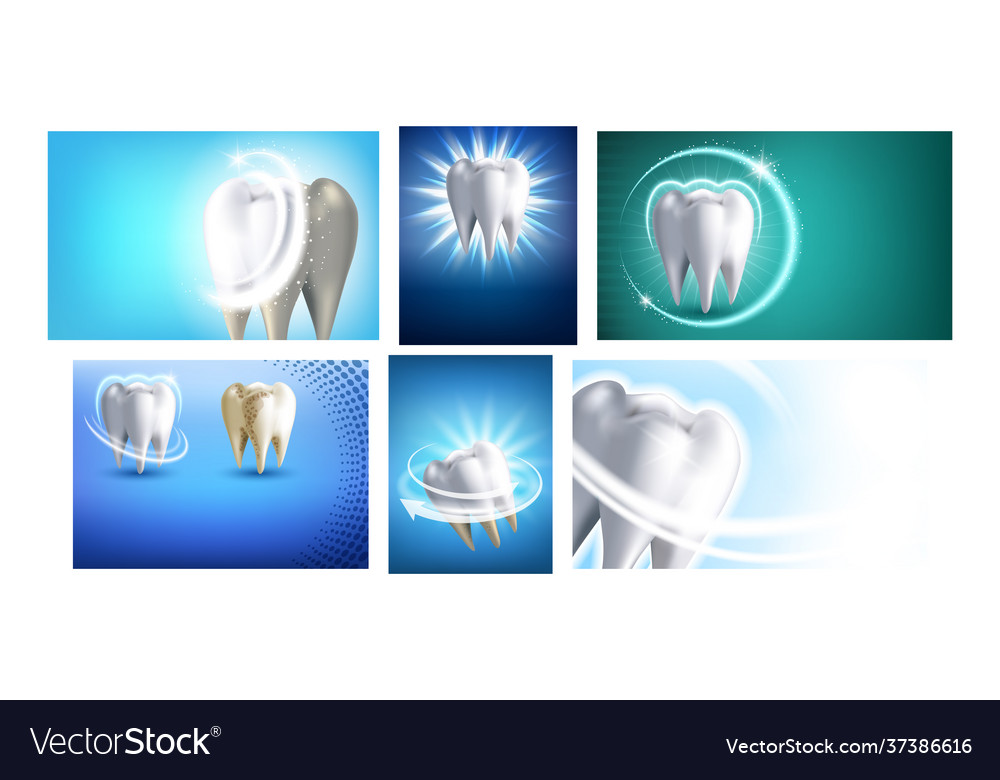 Teeth whitening promotional posters set Royalty Free Vector