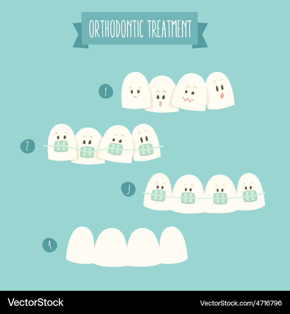 Orthodontic treatment tooth braces Royalty Free Vector Image