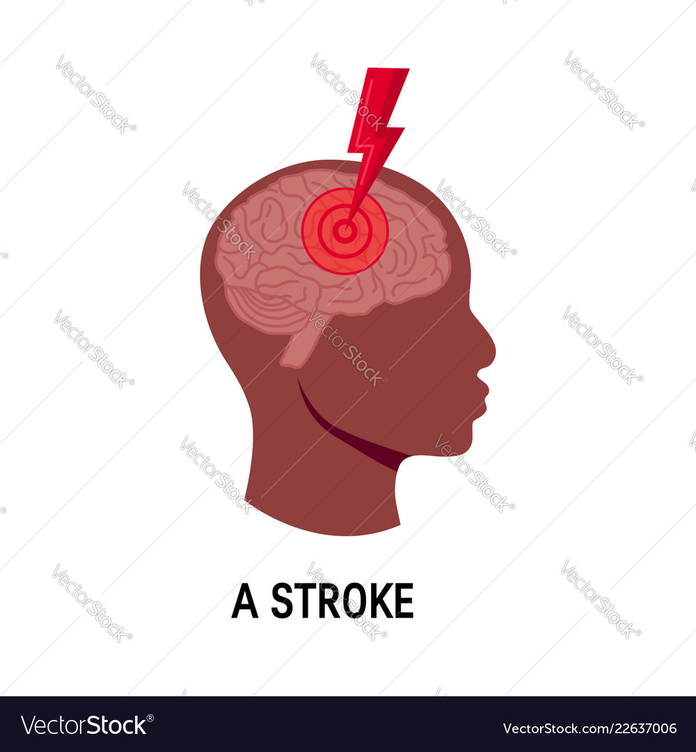 Stroke concept Royalty Free Vector Image - VectorStock